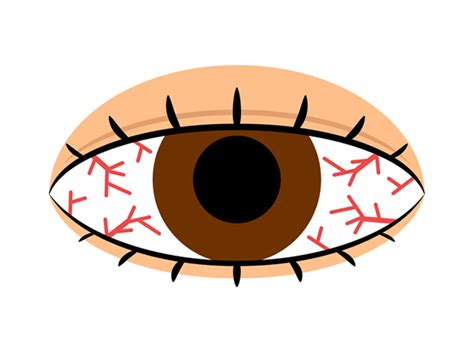 눈 핏줄 한 번 생기면 영원히 안 사라진다