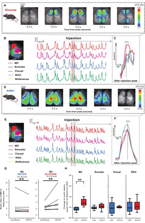 Real Time Analysis Of Gut Brain Neural Communication Cortex Wide