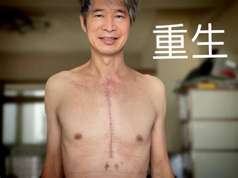 2020 11 13 心臟主動脈剝離沒死閻羅王拒收 出院後展開新的人生更豁達 半年後的每一天都只吃自己動手準備的早餐 兩年後