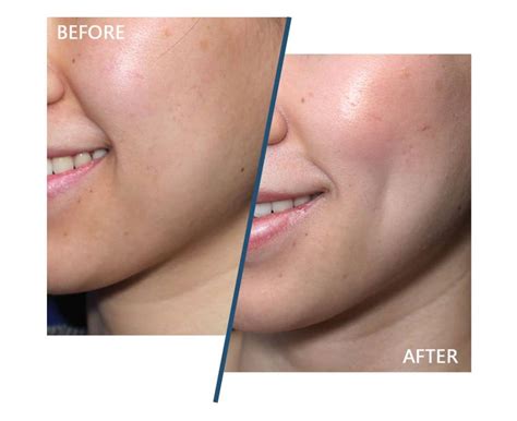 1dimple Best Photos On