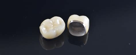Ada Dental Code For Crowns At Rosie Caldwell Blog