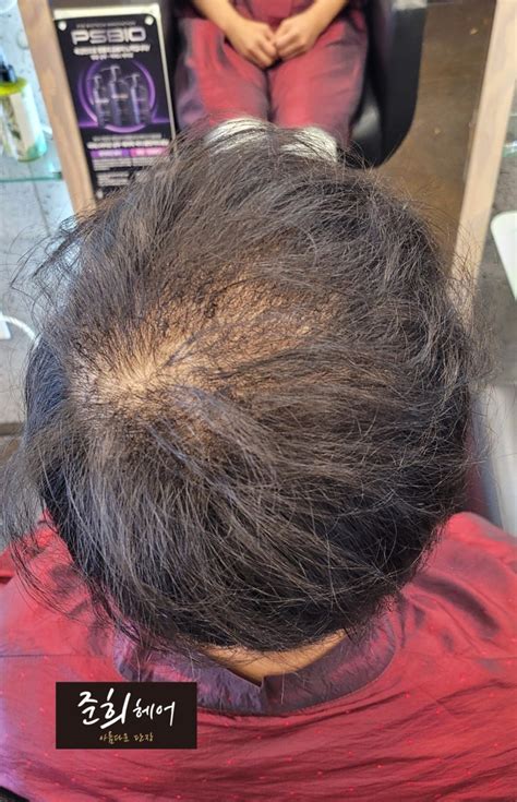 김포 장기동 미용실 준희헤어 여성탈모 링거펌 네이버 블로그