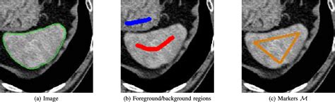 Figure 1 From Parameter Free Selective Segmentation With Convex