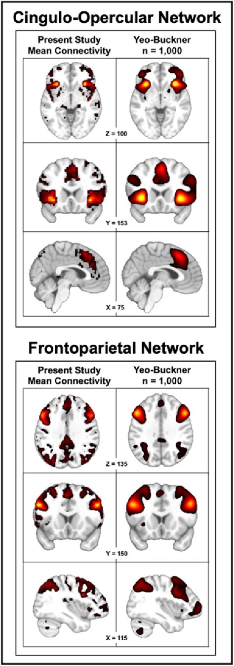Cingulo Opercular And Frontoparietal Networks Upper Panel Depicts The Download Scientific