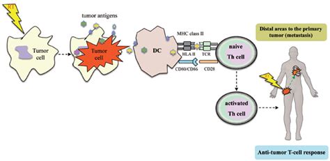 The Abscopal Effect Radformation