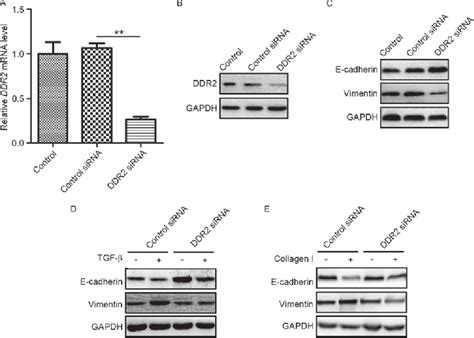 Figure 3 From Ddr 2 Facilitates Papillary Thyroid Carcinoma Epithelial