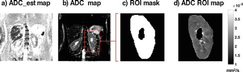 Example Maps From A Healthy Volunteer Illustrating The Steps For ADC Download Scientific