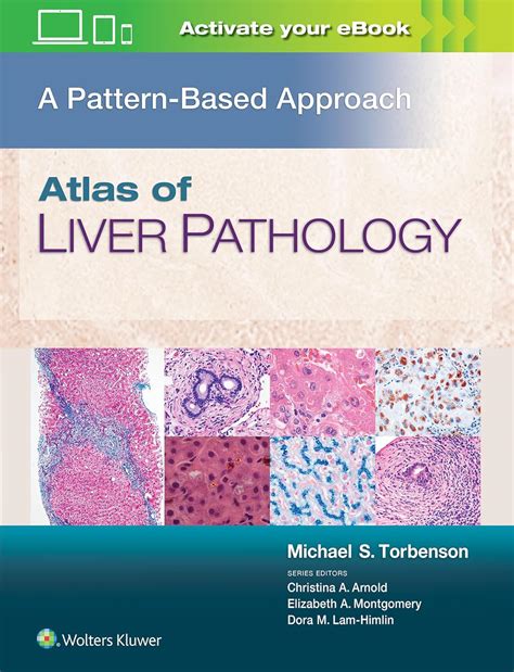 Buy Atlas Of Liver Pathology A Pattern Based Approach Hb 2020 Book Online At Low Prices In