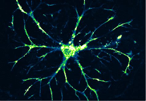 Astrocytes The “stars” Of Our Central Nervous System Pennneuroknow