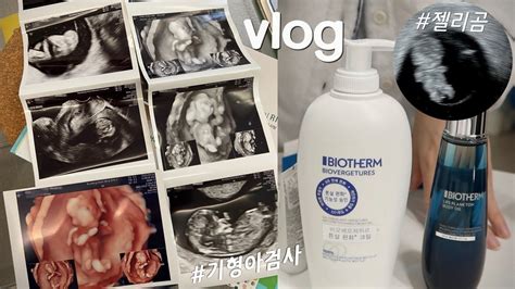 임신 브이로그 시부모님 임밍아웃 • 1차기형아검사 목투명대 • 8~12주차 임산부 후굴자궁 아기성별은 🧸 젤리곰 초음파 • 앓아누운 임신초기 입덧 Youtube