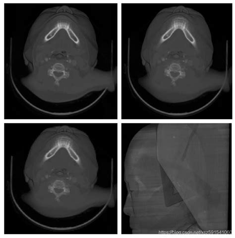（医学三维重建）matlab体绘制算法：光线投射（rc）三维超声图像光线投影算法 Csdn博客