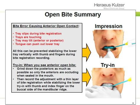 Preventing Anterior Open Bites Final Ppt