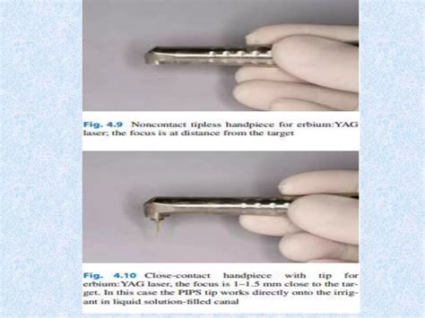 Lasers In Endodontics Pptx