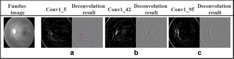 Visualization Of Feature Maps And The Corresponding Deconvolution Download Scientific Diagram