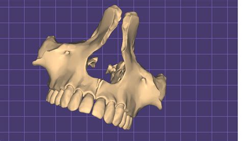 Stl File Maxilla・model To Download And 3d Print・cults