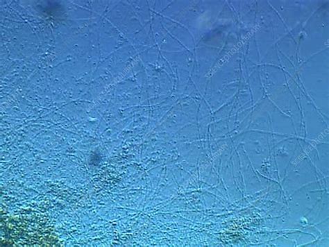 Filamentous Bacteria Stock Video Clip K002 1589 Science Photo Library