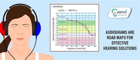 Decoding The World Of Audiograms Your Guide To Hearing Health Aanvii Hearing