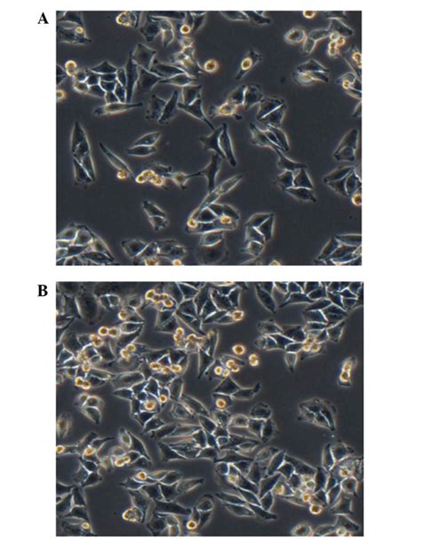 Construction Of Ang2 Sirna Chitosan Magnetic Nanoparticles And The