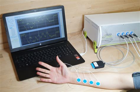 Impedance Measurement Of A Forearm With The Sciospec Medical Research ISX 3 Impedance Analyzer