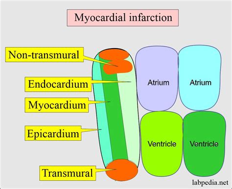 Cardiac Marker Part 1 Diagnosis Of Acute Myocardial Infarction Ami