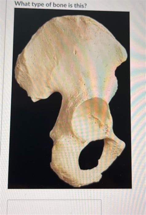 Solved What Tvpe Of Hnno Ic Thie