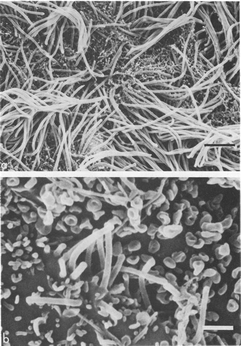 Sem Of Noninfected Ependymal Organ Culture Note The Numerous Cilia And
