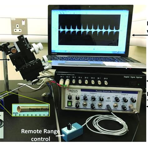 Doppler Signal Processing Workstation Users Interphase Download Scientific Diagram