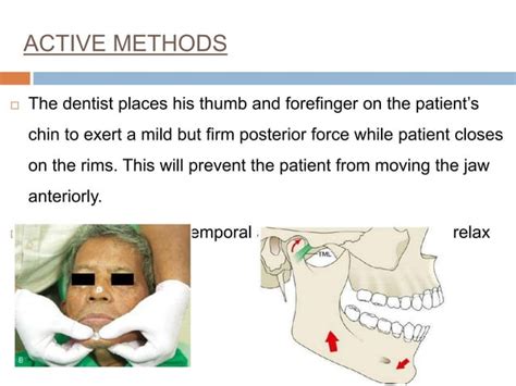 Centric Relation Relevance And Role In Complete Denture Construction Pptx