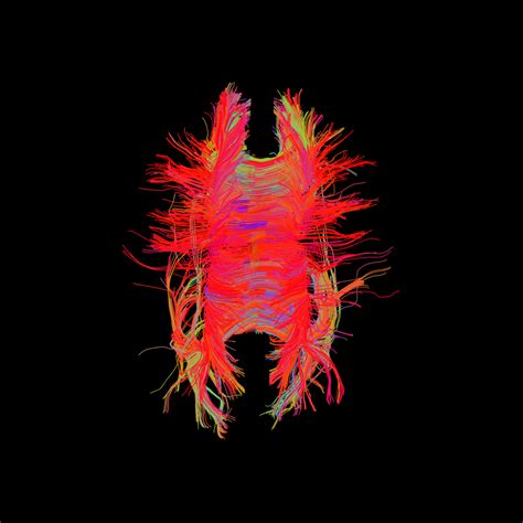 An Introduction To The Deterministic Tractography — Dipy 1 11 0 Documentation