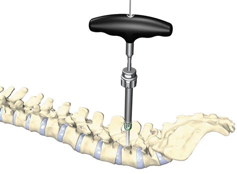 Keith Shevlin Posted On Linkedin