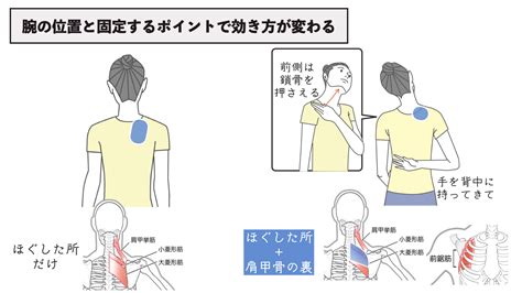 肩甲骨はがしの筋膜リリースで効果的なポイント・コツ バレエダンサーさんの治療院