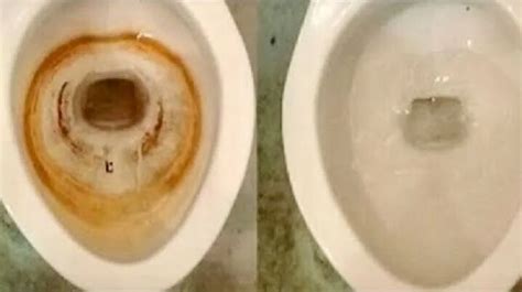 Мощный способ Как очистить унитаз от мочевого камня и известкового налёта Смотреть онлайн в