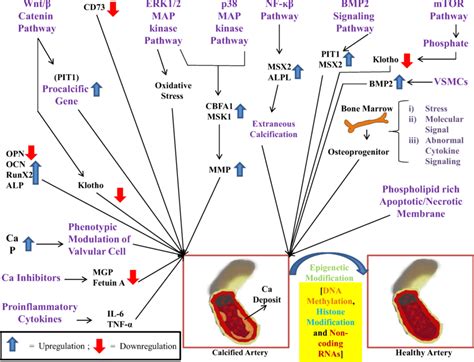 Schematic Diagram For The Arterial And Aortic Valve Calcification