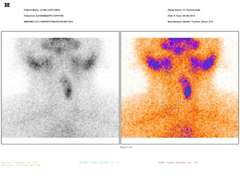 Imaging Lily