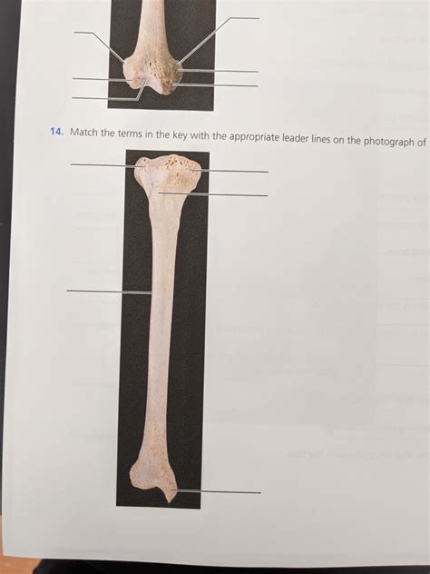 Tibia Diagram Quizlet