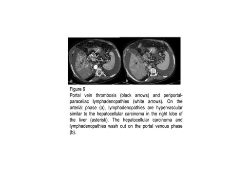 Dynamic Multidetector Computed Tomography Ppt