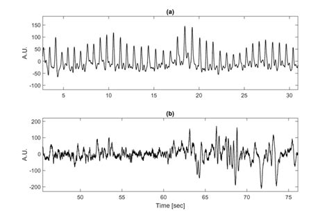 1 Example To Illustrate How Motion Artifacts Can Corrupt The Ppg Download Scientific Diagram