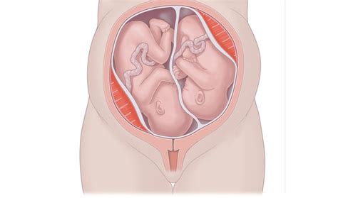 일란성 이란성쌍둥이 세쌍둥이 네쌍둥이 쌍둥이자연분만 쌍둥이낳는법 네이버 블로그