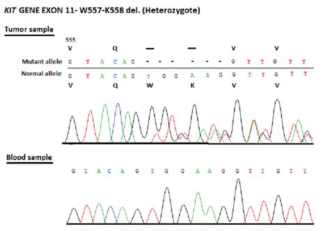 Kit Gene Exon 11 W557 K558 Deletion Heterozygote The Most Common Download Scientific