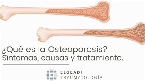 Bula Del Trofodermin Clostebol Neomicina Información Beneficios Y