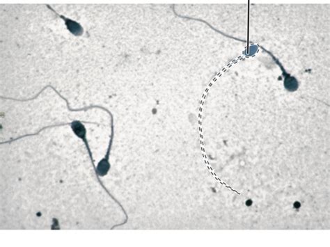 Reproductive System Histology Flashcards Quizlet