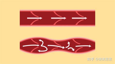 冻疮疤痕怎么去除 知乎