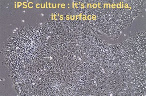 When Culturing Ipscs The Most Important Consideration Isnt What Media When Culturing Ipscs The Most Important Consideration Isnt What Media