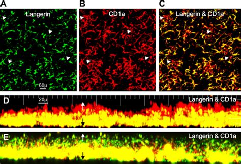 In Situ Langerin And Cd1a Staining Of Lcs Embedded Within Intact