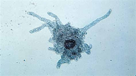 Amoeba Under Microscope 100x