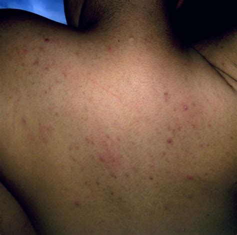 Red Spots On Skin 13 Common Causes Usa