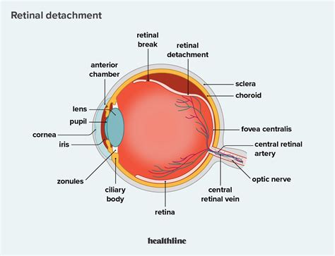An Overview On Retinal Detachment