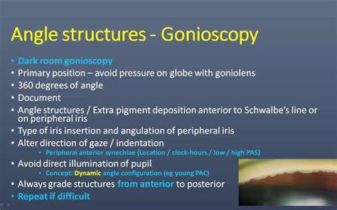 Primary Angle Closure Glaucoma International Ophthalmology Portal