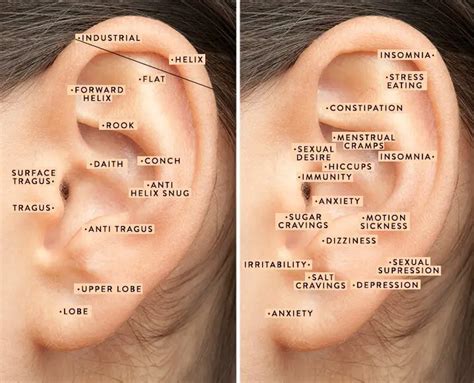 Auriculoterapia Para Bajar De Peso ¿qué Es Y Cómo Funciona Con Balines