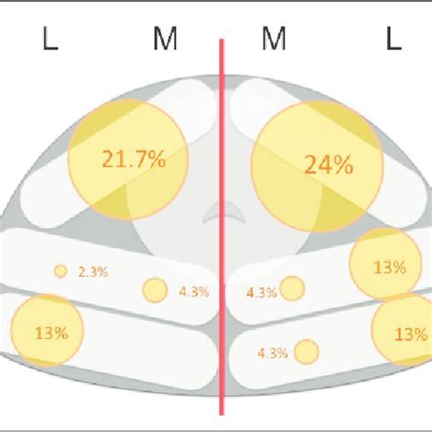 Conversion Table Of The Anatomic Prostatic Mri Zones Pi Rads Mapping Download Table